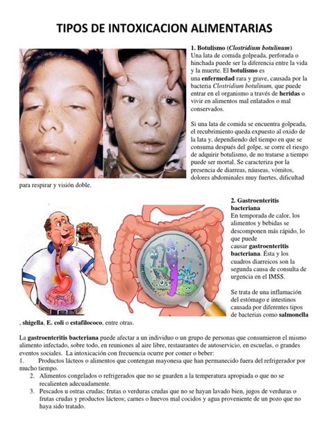 Tipos De Intoxicacion Alimentarias Pdf Alimentos Especialidades