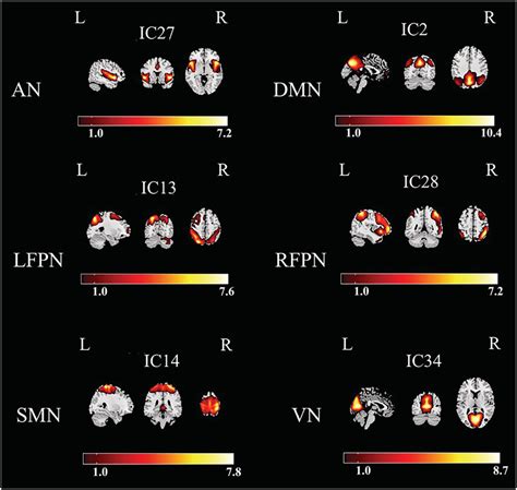 functional relevant resting‐state networks rsns the spatial maps of