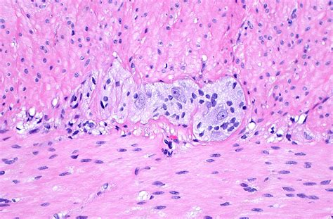 Myenteric Nerve Plexus Cells Light Micrograph Stock Image C058