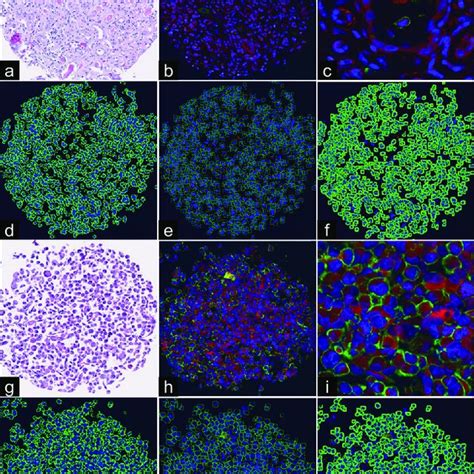 Segmentation Of Fluorescence Digital Tissue Images Slides Were Scanned