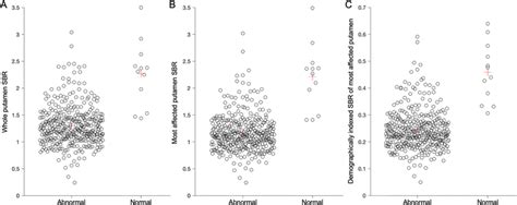 Quantitative Evaluation Of Dat Spect Striatal Binding Ratio Sbr