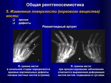 Лучевая диагностика костно-суставной системы - презентация онлайн