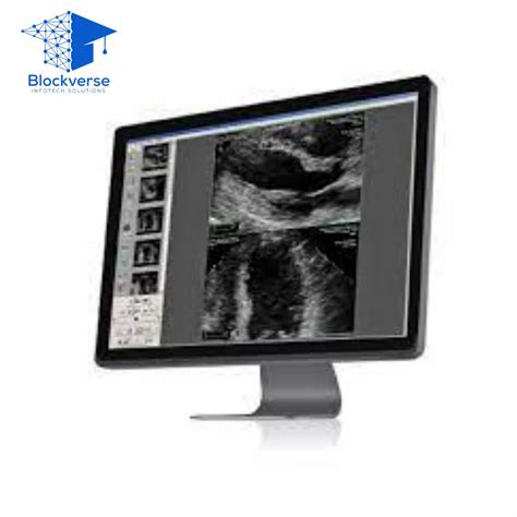 Pacs Software At Best Price In Jaipur By Blockverse Infotech Solutions Llp Id 2852541824962