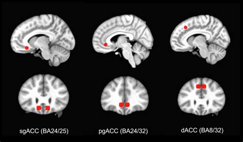 Ketamine S Antidepressant Effects Involve An Evolutionarily Ancient Part Of The Brain Research