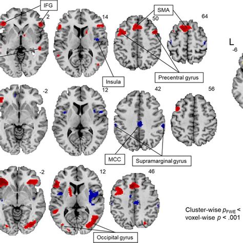 Whole Brain Functional Brain Maps Depicting Increased Activation