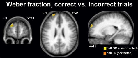 Neural Coding Of Tactile Decisions In The Human Prefrontal Cortex Journal Of Neuroscience