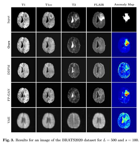 Diffusion Models For Medical Anomaly Detection 知乎