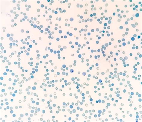 Premium Photo Close View Of Reticulocyte Count Under Microscope