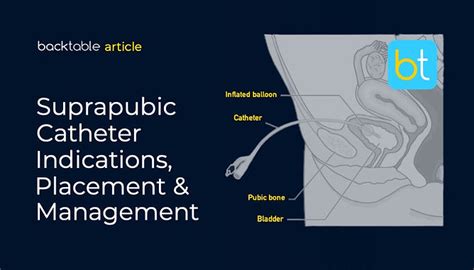 Suprapubic Catheters Placement Care And Risks Explained
