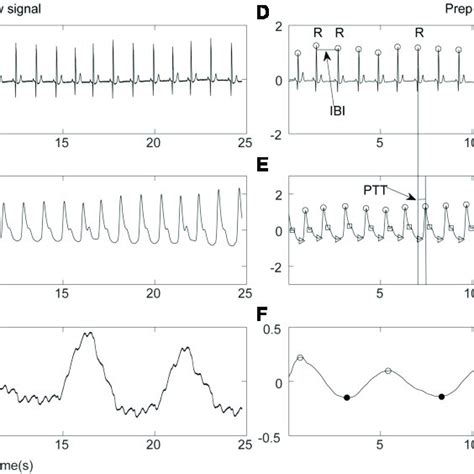 Schematic Diagram Of Physiological Signal Preprocessing A Original