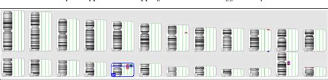 Figure 4 From Microduplication And Microdeletion Syndromes Diagnosed Prenatally Using Single