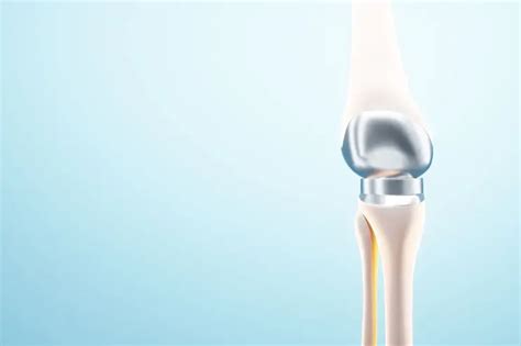 Comprehensive Joint Reconstruction Surgery