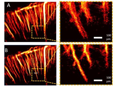 Translation Correction In The Rats Brain A Ulm Without Correction B