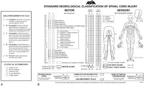 Injuries Of The Lower Cervical Spine Musculoskeletal Key