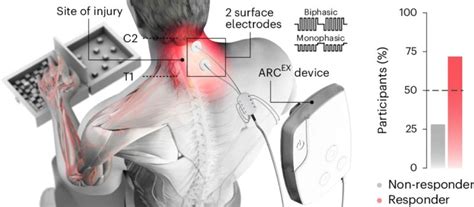 Bioelectronics Drop On Linkedin Sci Research Bioelectronics Rehab