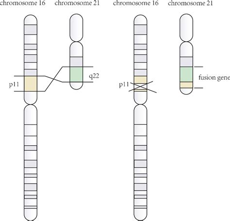 The Reciprocal Translocation Between 16p11 And 21q22 The Yellow Part Download Scientific