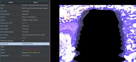 Toluidine Blue Deconvolution Usage And Issues Imagesc Forum