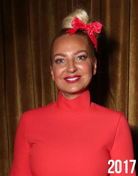 Sia 48 Shows Off Her Recent Facelift In New Photos From Her Retur