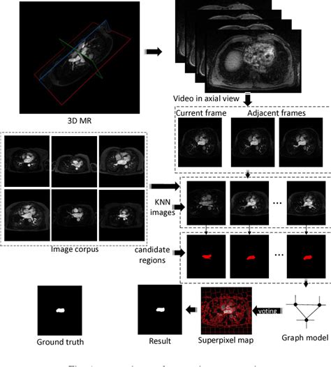 Figure From Automatic Segmentation Of The Left Atrium From MR Images Via Semantic Information