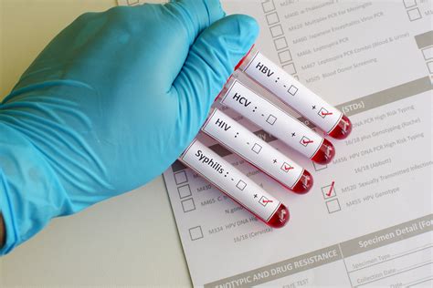 Why You Must Undergo Std Testing In Washington Dc Without Delay