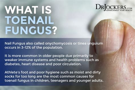 Toenail Fungus Symptoms Causes And Support Strategies