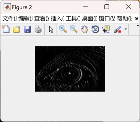 虹膜检测虹膜检测和胆固醇分析眼睛图像Matlab实现 CSDN博客