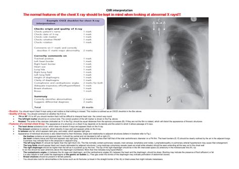 Cxr Interpretation Checklist Short Pdf Lung Thorax