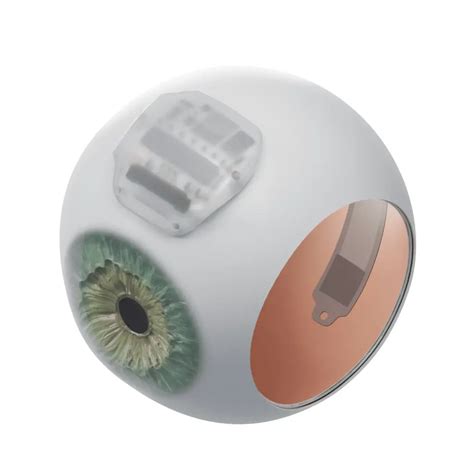 A Revolutionary Microled Based Optogenetic Visual Prosthesis For Human Eye Replacement Display