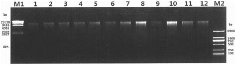 Method For Detecting Rhizobacteria Communities Based On 16s Rdna Full