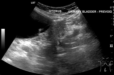 Image Radiopaedia Org