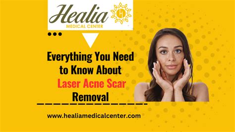 Everything You Need To Know About Laser Acne Scar Removal Healia