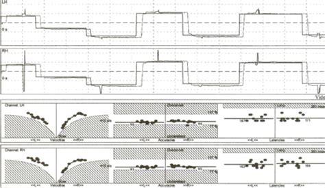 Vng Testing Flashcards Quizlet