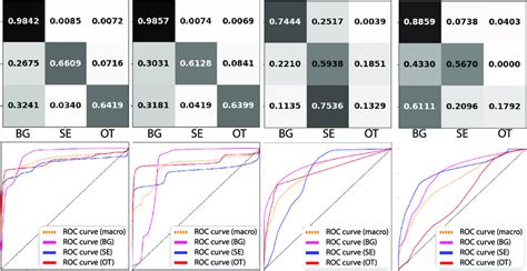 Confusion Matrices And The Corresponding Auc Roc Plots Of The