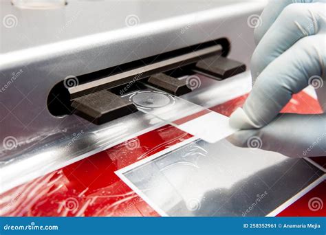 Scientist Preparing Microscope Slides With Liquid Based Cytology Method For Pap Smear Test