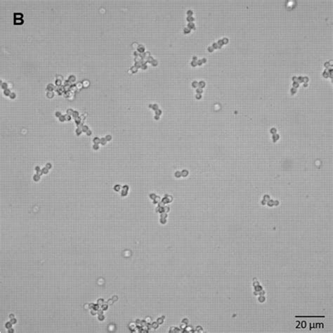 Pdf Production Of A Recombinant Peroxidase In Different Glyco Engineered Pichia Pastoris