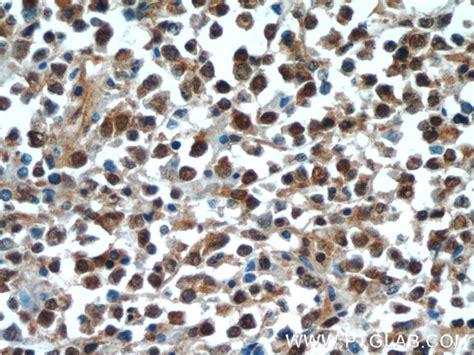 C Myc Antibody 10828 1 Ap