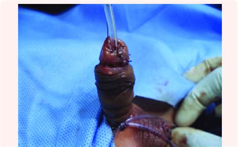 Photo Showing Completed Repair Download Scientific Diagram