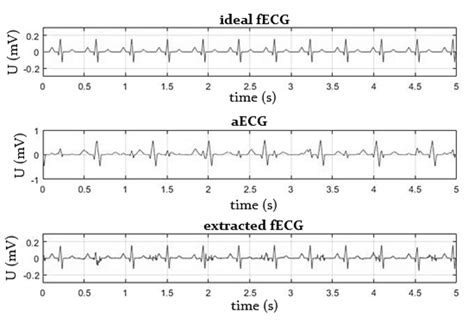 visual evaluation of fecg signal extraction in time domain download