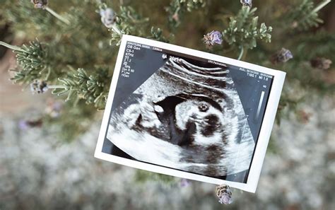 Quand Et Comment Connaître Le Sexe Du Bébé à Léchographie
