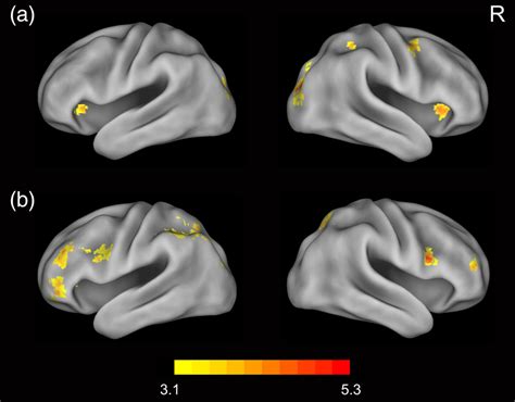 The Effect Of Language Experience On Cross‐language Pattern Similarity
