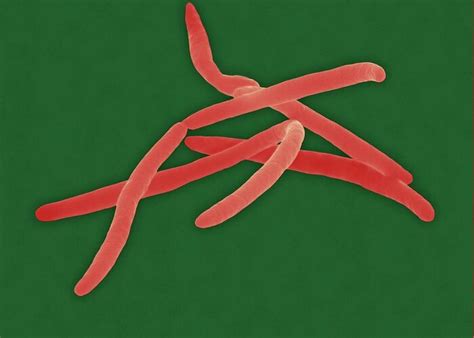 Fusobacterium Nucleatum 3 Greeting Card By Science Photo Library