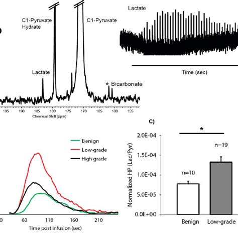 Hyperpolarized Hp 13 C Spectroscopy Of Tscs A Representative
