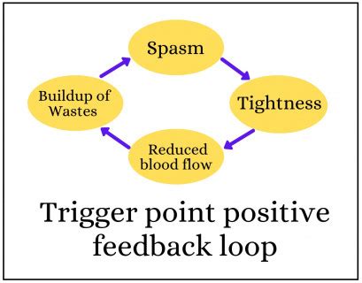 How To Treat Trigger Points At Home How To Treat Trigger Points At Home
