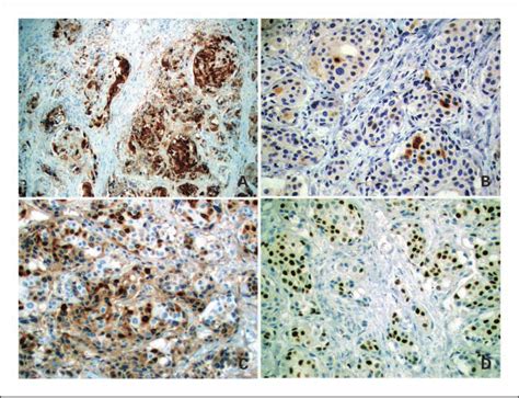 Immunohistochemical Staining Patterns For Ctas A Strong Staining Of Download Scientific