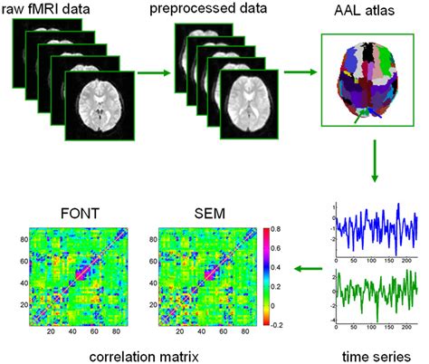 Illustration Of The Procedures Used To Construct Brain Functional