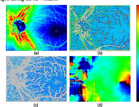 Figure 1 From Retinal Nerve Fiber Bundle Tracing And Analysis In Human