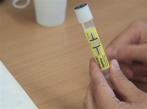 Chlamydia Test And Its Benefits My Healthy Life Vision