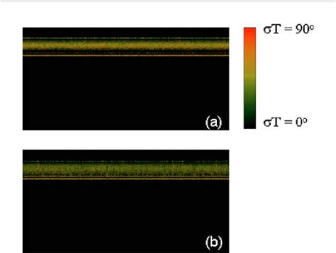 Figure 2 From Feasibility Of Doppler Variance Imaging For Red Blood Cell Aggregation