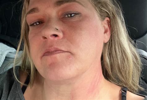 Mynameiscarolynnandisurvived Fundraiser By Carolynn Caroselli On Spotfund