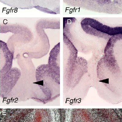Fgf8 And Fgfr1 Are Expressed In Midline Precursor Cells A D